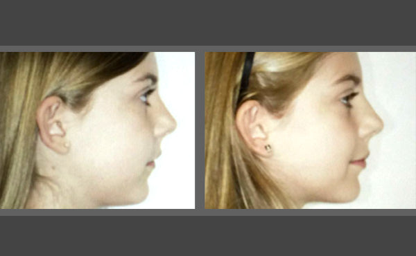 GOPEx – Forwardontics